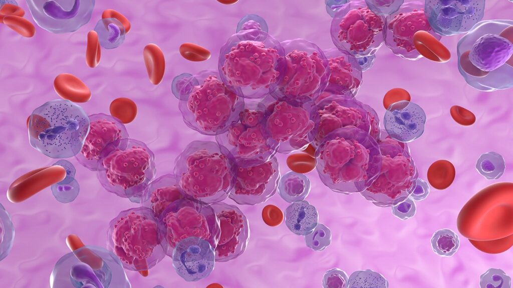 Vart tredje barn med leukemi har D-vitaminbrist - forskning.se