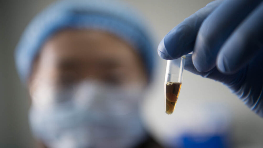 Gentester kan ge skräddarsydd behandling - forskning.se