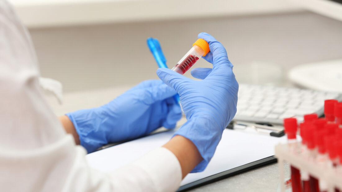 Sänk ditt blodtryck − det här kan du göra själv - forskning.se